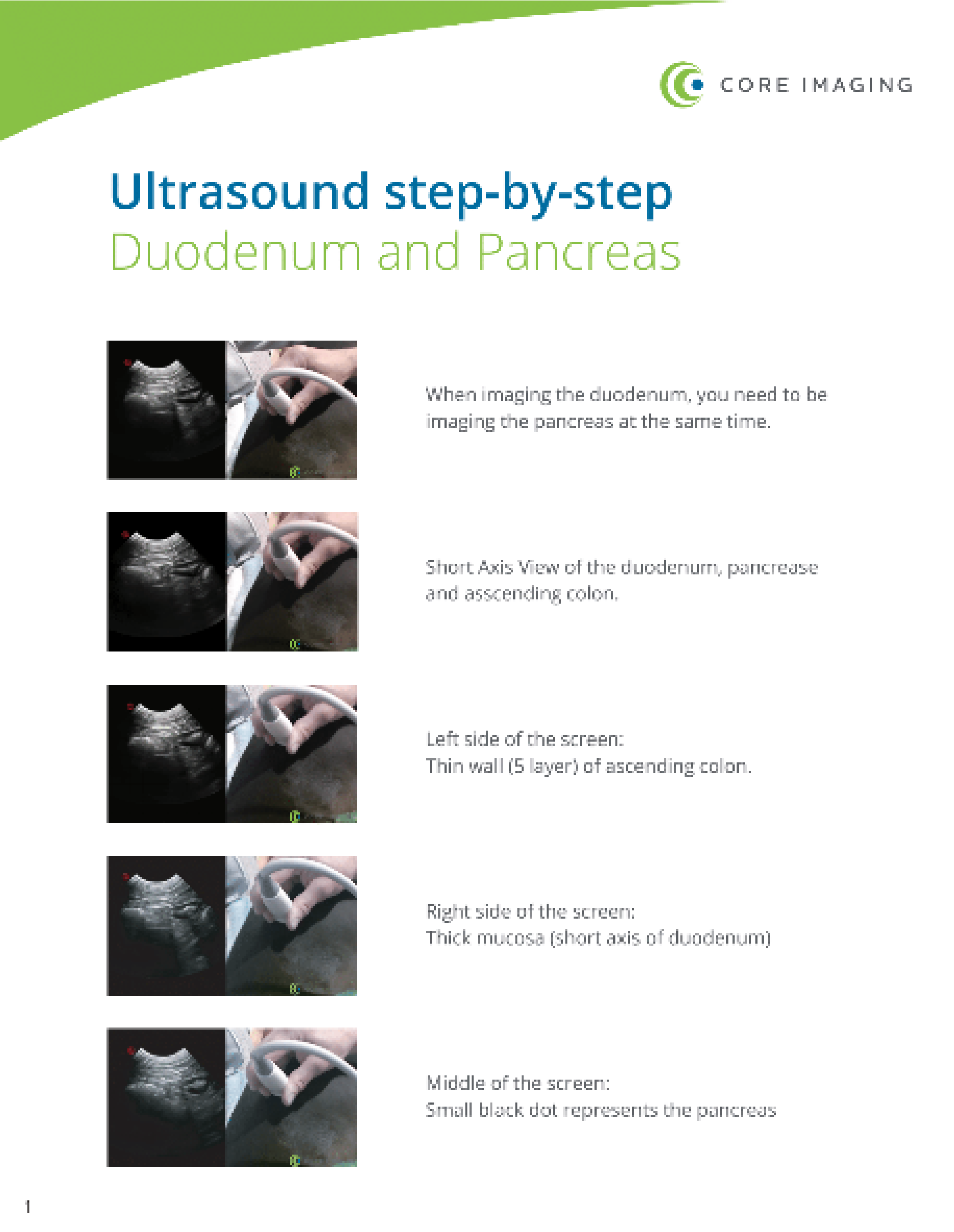 Step-by-Step Ultrasound Guide: Duodenum and Pancreas — Core Imaging