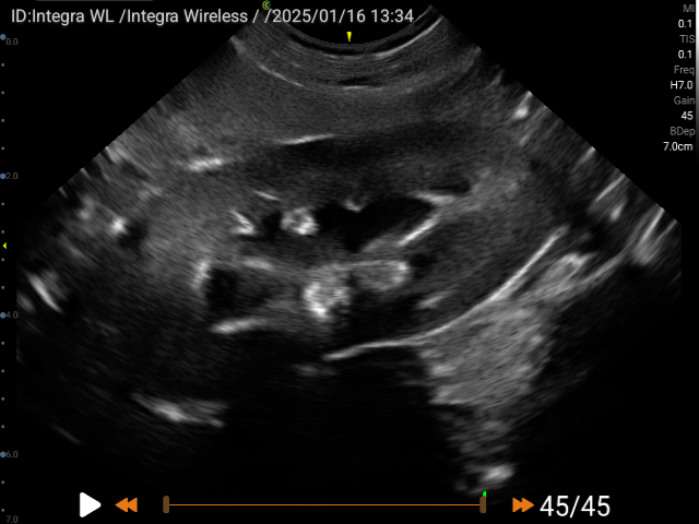 Integra Wireless | Core Imaging